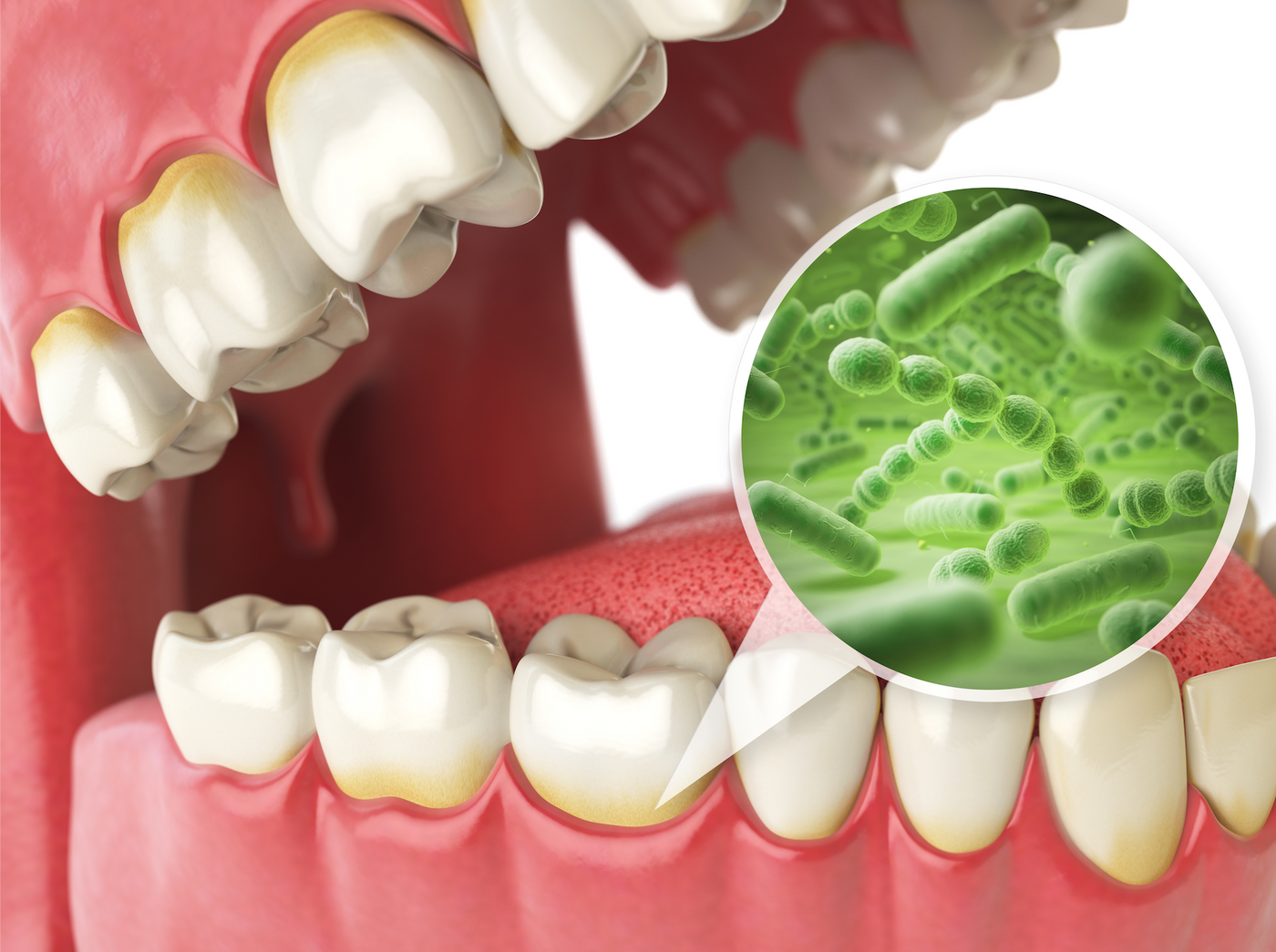 What is Oral Microbiome? Restore Imbalanced Mouth Bacteria